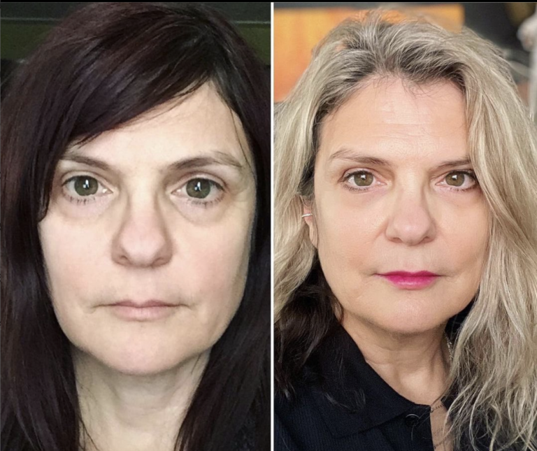 A Non-Surgical Refresh | FORM Face + Body